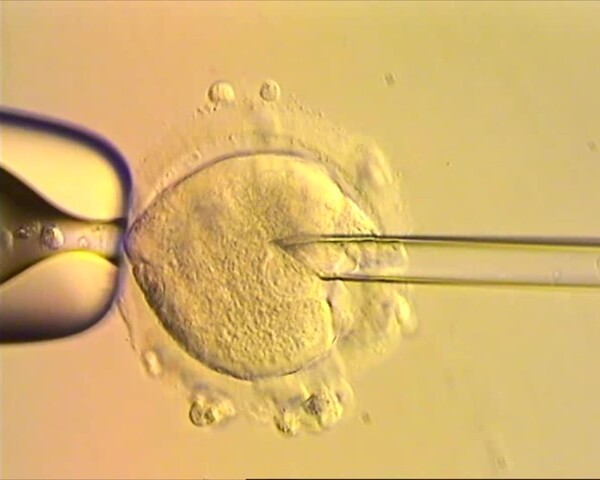 Eight babies born in UK using three-person IVF, preventing genetic diseases